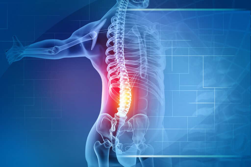 Reading X-Rays, CT & MRI Scans: What Does It All Mean? - Therapia