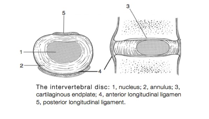 Lumbar Spine Disk Herniation and How Physio Can Assess or Treat it?