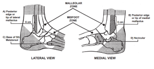 What is Ankle Inversion Sprain and How a Physio can help? - Therapia
